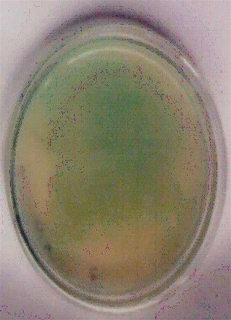 P Aeruginosa On Pseudomonas Isolation Agar Medium Download Scientific Diagram