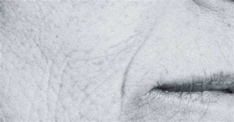 Understanding Dynamic Vs Static Wrinkles