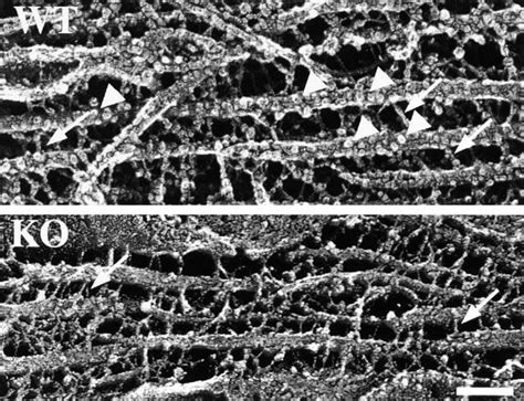 The Dendritic Cytoskeleton Of Wild Type And Map2 Knockout Mice Download Scientific Diagram