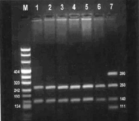 Detection Of The Hfe C282y Mutation By Pcr Rflp With C282y Primers And Download Scientific