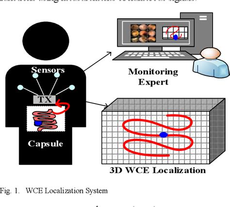 Figure 1 From Wireless Capsule Endoscopy Using Localization Techniques