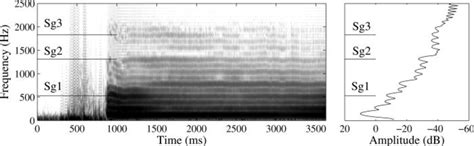 Spectrogram Of The Accelerometer Signal During Sustained Production Of Download Scientific