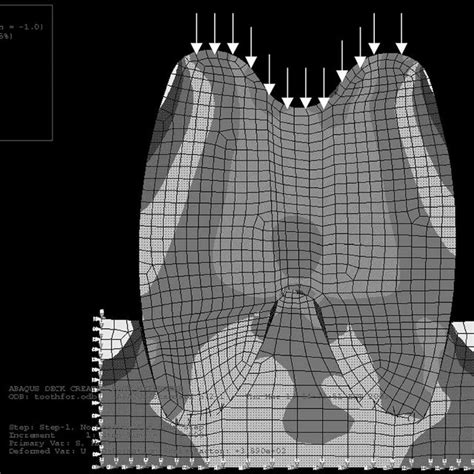 A 2 Dimensional Finite Element Model Of The Crown Of A Premolar Arrows Download Scientific