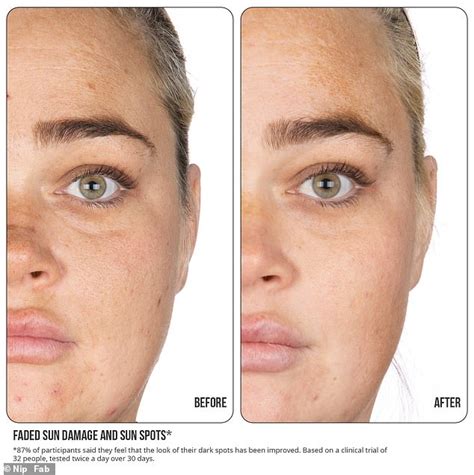 See The Before And After Photos Following Use Of The Nip Fab Vitamin C Fix Concentrate 15