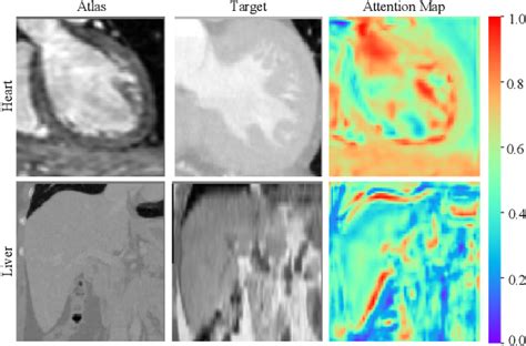 Figure 5 From Cross Modality Multi Atlas Segmentation Via Deep Registration And Label Fusion