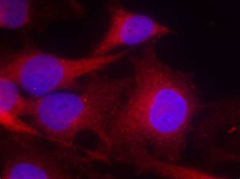 兔抗plcg2多克隆抗体anti Plcg2 Ab 753 Rabbit Polyclonal Antibody 生命科学产品与技术服务