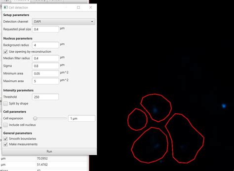 Cell Detection Issues In Qupath Image Analysis Imagesc Forum