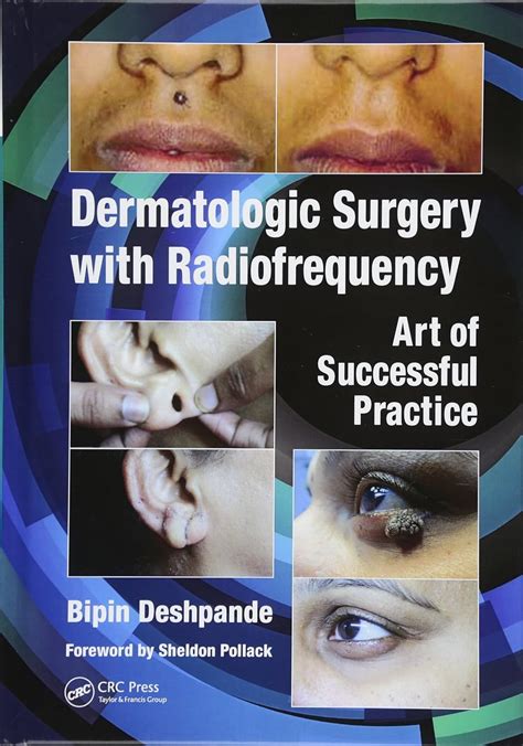 Buy Dermatologic Surgery With Radiofrequency Art Of Successful