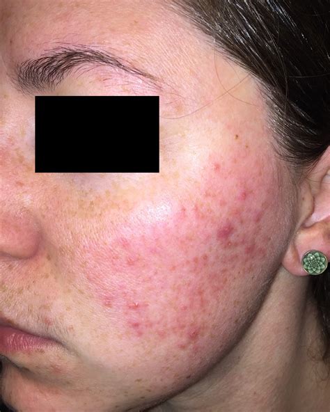 Patient Photos