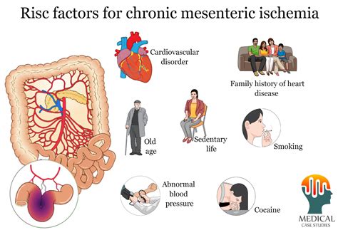 Ibs And Chronic Mesenteric Ischemia Med Case Studies