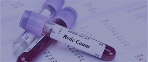 آزمایش Retic Count آزمایش شمارش رتیکولوسیت هومکا