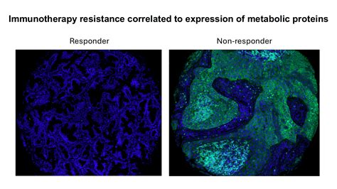 Nucleai Presents Ai Powered Spatial Biomarker Breakthroughs To Enhance Immunotherapy At Sitc 2024