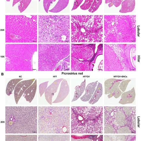 Diagnostic Algorithm For Differentiation Of Nafld And Nash At The Liver Download Scientific