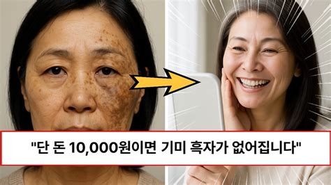 스마트뉴스 댓글에서 볼 수 있어요 ♥ 이거면 끝입니다” 10년 차 피부과 의사가 알려주는 기미 흑자 없애는 초간단 방법 Facebook