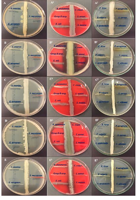 Figure 1 From Gas Chromatographymass Spectrometry Profiling Of Volatile Metabolites Produced By