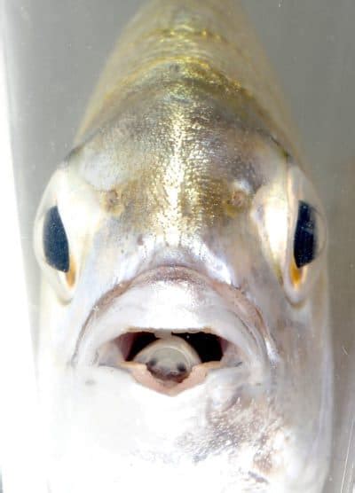 Why Losing Parasites Could Have Devastating Effects On Our Ecosystem Ncpr News