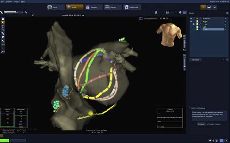 Cardiac Mapping Systems Cardiac Electrophysiology Clinics