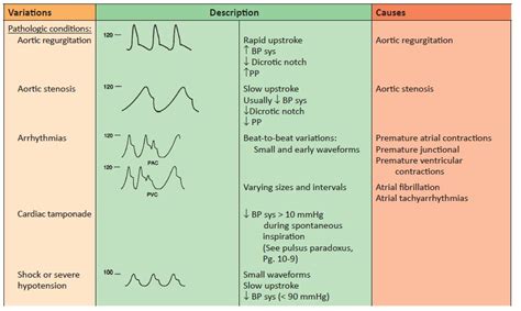 Arterial Pressure Waveform Variations Member Login Oakes Academy Arterial Pressure Waveform Variations Member Login Oakes Academy