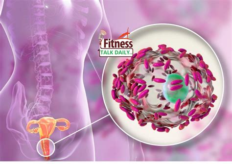 Aerobic Vaginitis Av Symptoms Causes Treatment And Prevention