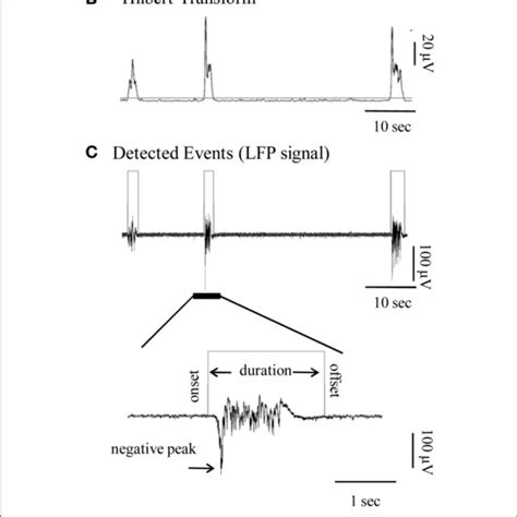 Detection And Quantification Of The Local Field Potential Lfp Download Scientific Diagram
