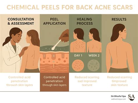 Back Acne Scars Chemical Peels