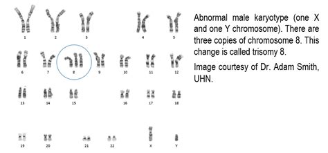 කාරියොටයිප් යනු කුමක්ද Mypathologyreport