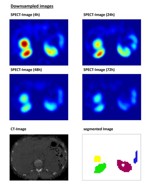 2 the four spect images the ct image and the corresponding