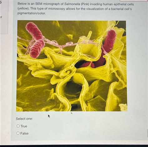 Solved Below Is An Sem Micrograph Of Salmonella Pink