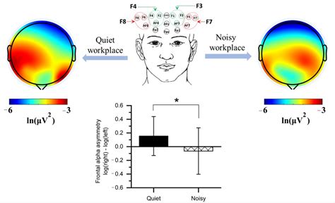 Electroencephalogram Alpha
