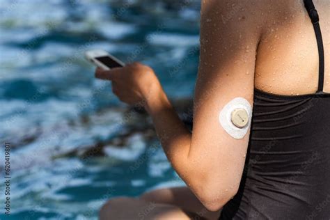 Know Labs Announces Wearable Non Invasive Continuous Glucose Monitor
