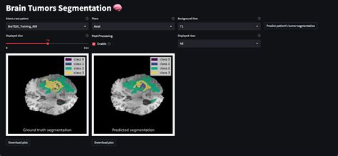 Ai Deploy Tutorial Deploy A Brain Tumor Segmentation App Using Streamlit Ovhcloud