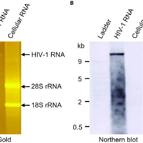 Visualization Of Full Length Hiv 1 Genomic Rna A Hiv 1 Rna Purified Download Scientific