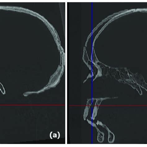 Manual Alignment And Synchronisation Of The Stack With Control Stack Download Scientific