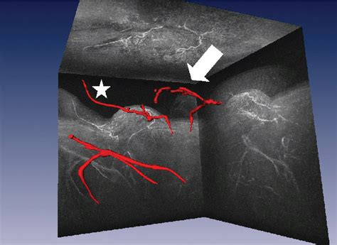 Figure 3 From Engineering Of Vascularized Transplantable Bone Tissues