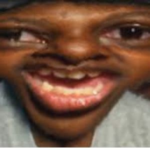 Twitch