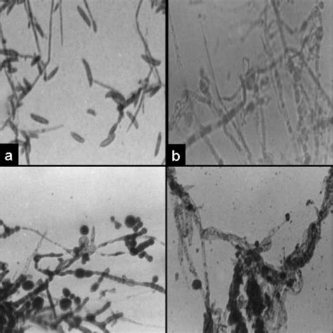 Growth Inhibition Of Pectobacterium Carotovorum Subsp Carotovorum Pc Download Scientific