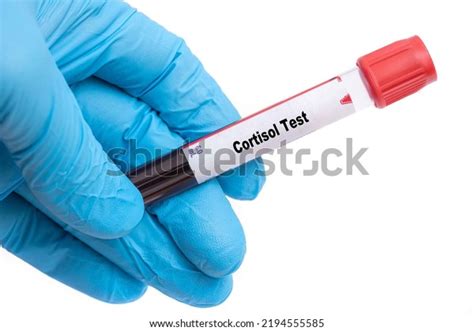 313 Cortisol Test 이미지 스톡 사진 및 벡터 Shutterstock