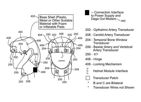 Doppler Ultrasound Patented Technology Retrieval Search Results