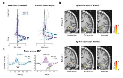 Two Hippocampal Sources During Memory Recognition Download Scientific Diagram