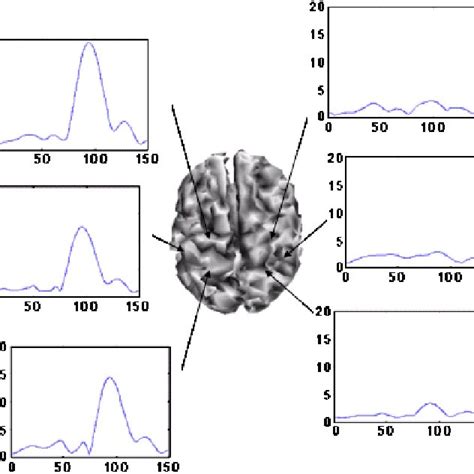 Scalp Recordings Before And After Surface Laplacian Filtering And Download Scientific Diagram