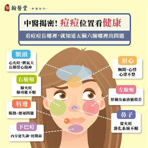中醫揭秘！痘痘長在這個位置 1張圖秒懂「健康警訊」 健康 三立新聞網 Setncom