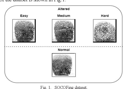Figure 1 From Enhanced Fingerprint Alteration Detection Using Lightweight Cnn Model Trained On