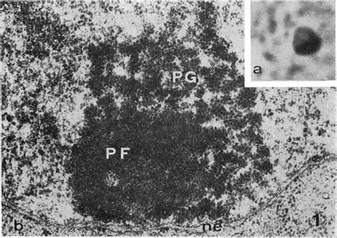 Nucleolus Micrograph