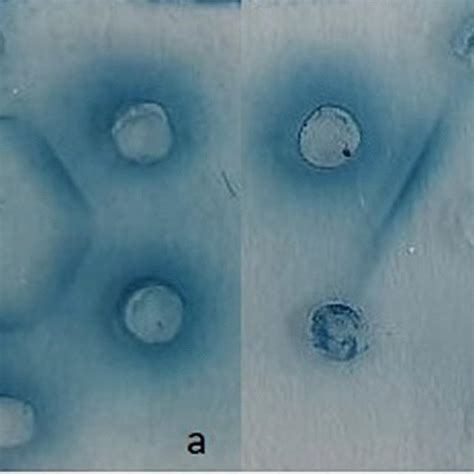Double Immunodiffusion Test Showing Positive A And Negative B Download Scientific Diagram