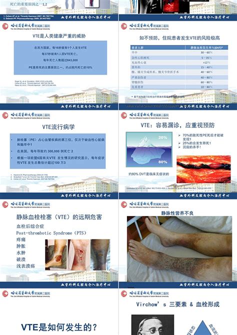 静脉血栓栓塞 VTE 诊断治疗和预防ppt模板 卡卡办公