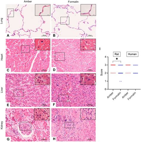 A Novel Tissue Preservation And Transport Solution As A Substitute For