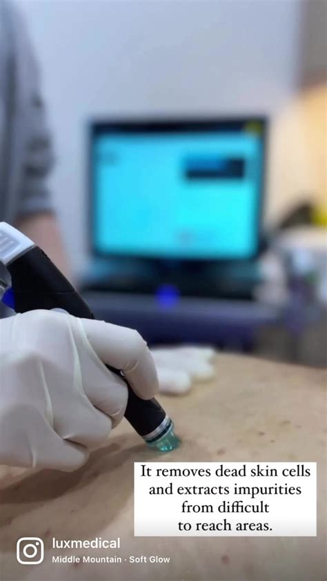 Back Acne Can Leave Unsightly Red Bumps And Hyperpigmented Marks The