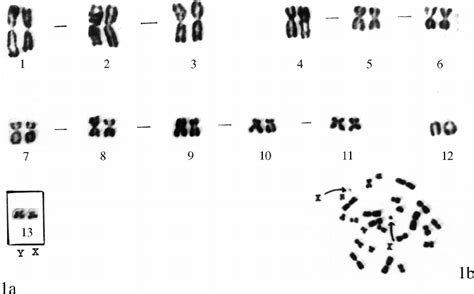 1a Somatic Metaphase Karyotype Of Male Xy Gegeneophis Krishni 1b Download Scientific