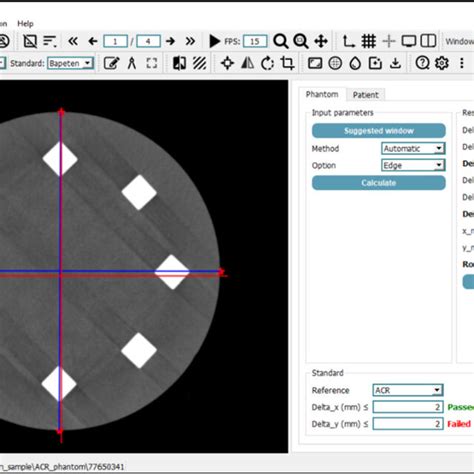 Graphical User Interface Gui Of Indoqct For Automated Assessment Of Download Scientific