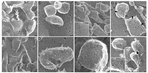 Toxins Special Issue Pore Forming Toxins